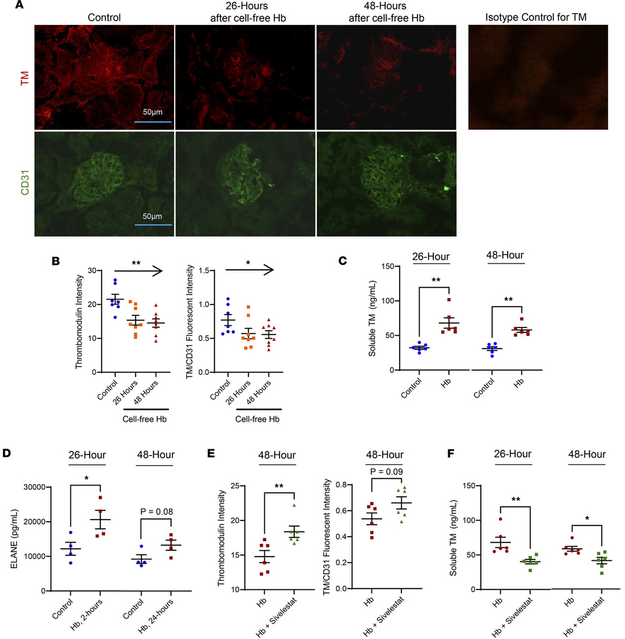 JCI Insight - Thrombomodulin protects against acute vascular and ...