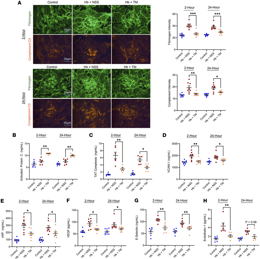 JCI Insight - Thrombomodulin protects against acute vascular and ...
