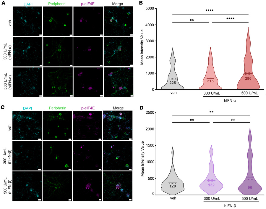 JCI Insight - Type I IFNs enhance human dorsal root ganglion nociceptor ...