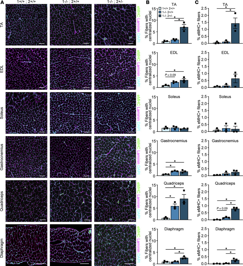 JCI Insight - Differential pathology and susceptibility to MBNL loss ...