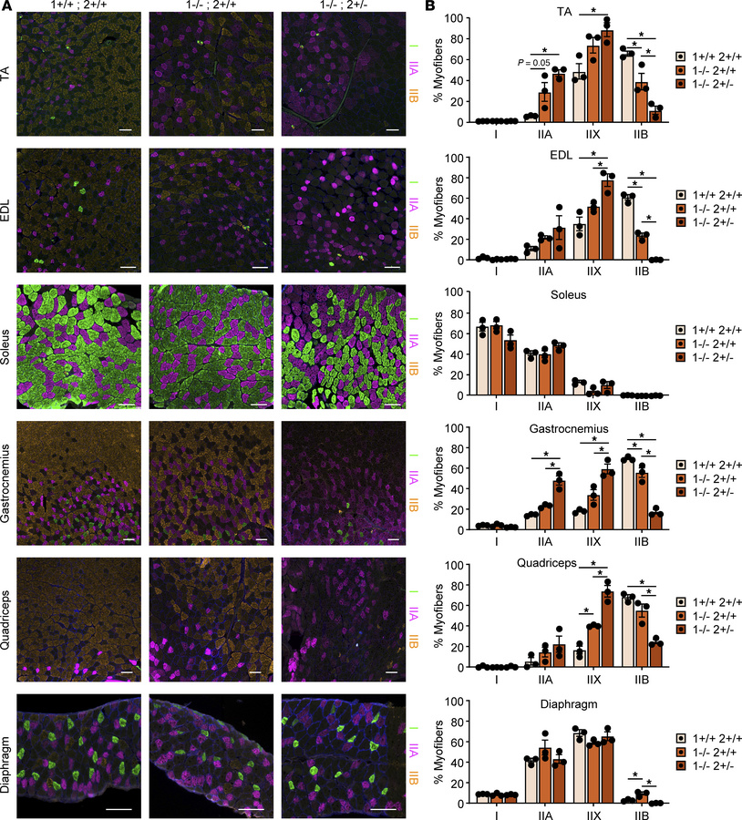 JCI Insight - Differential pathology and susceptibility to MBNL loss ...