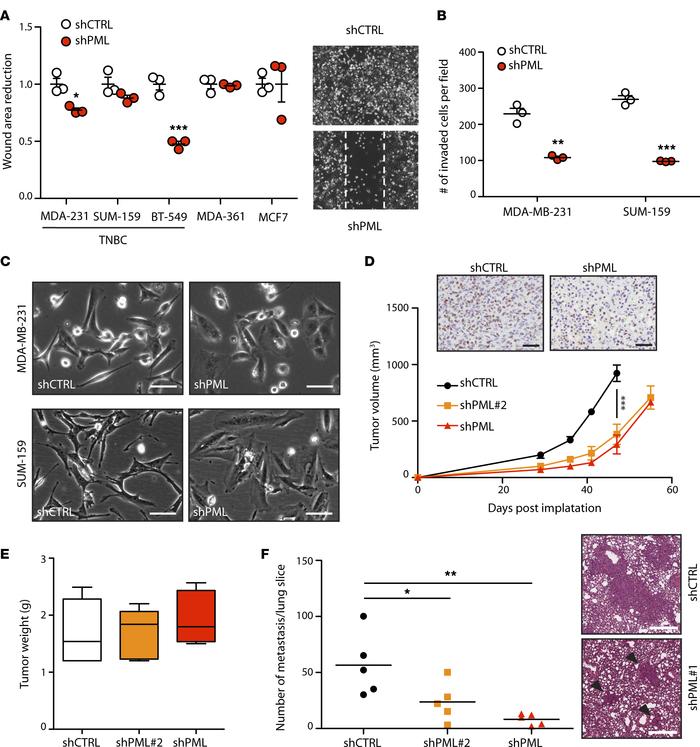 JCI Insight - PML promotes metastasis of triple-negative breast cancer ...