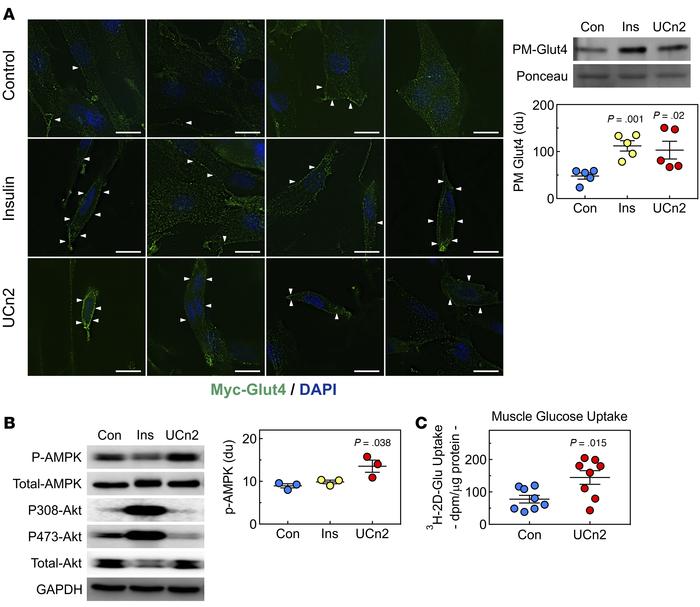 JCI Insight - One-time injection of AAV8 encoding urocortin 2 provides ...