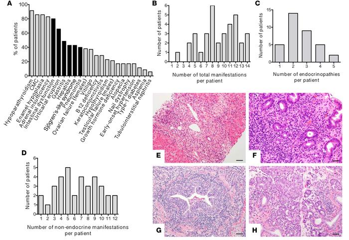 JCI Insight - Redefined clinical features and diagnostic criteria in ...