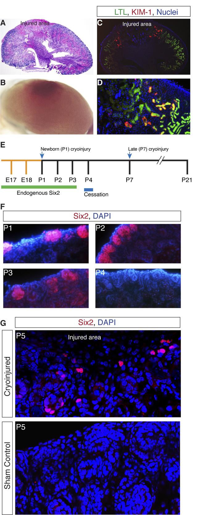 JCI Insight - Repair after nephron ablation reveals limitations of ...