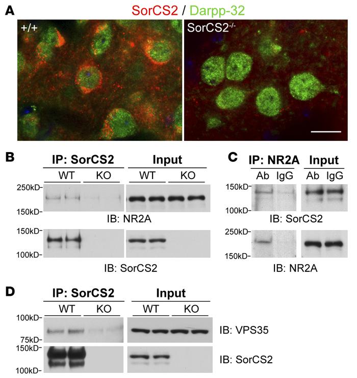 JCI Insight - SorCS2-mediated NR2A trafficking regulates motor deficits ...
