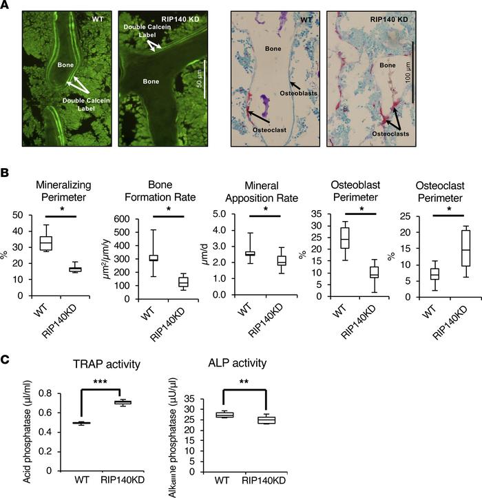 JCI Insight - RIP140 in monocytes/macrophages regulates osteoclast ...