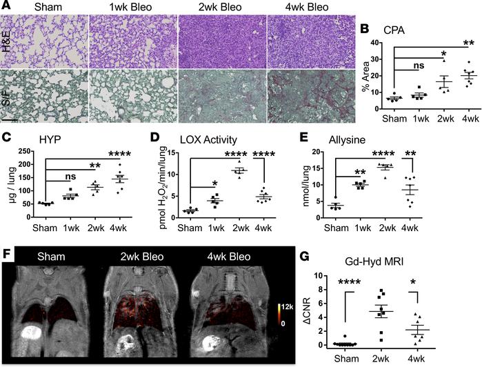 JCI Insight - Molecular imaging of oxidized collagen quantifies ...
