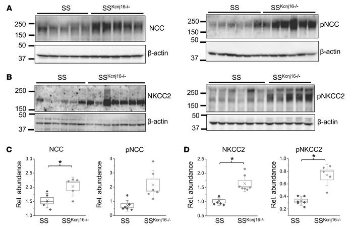 JCI Insight - Essential role of Kir5.1 channels in renal salt handling ...
