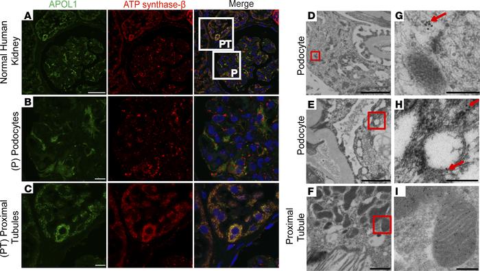 JCI Insight - APOL1 variants change C-terminal conformational dynamics ...
