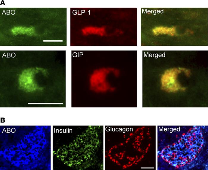 JCI Insight - Genetic determinants of circulating GIP and GLP-1 ...
