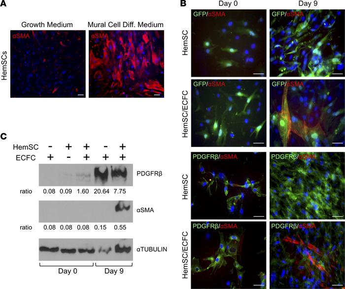 JCI Insight - NOTCH3 regulates stem-to–mural cell differentiation in ...
