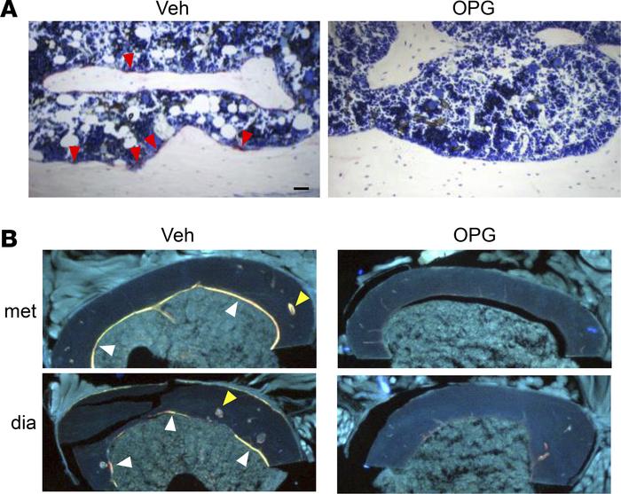 JCI Insight - Old age causes de novo intracortical bone remodeling and ...