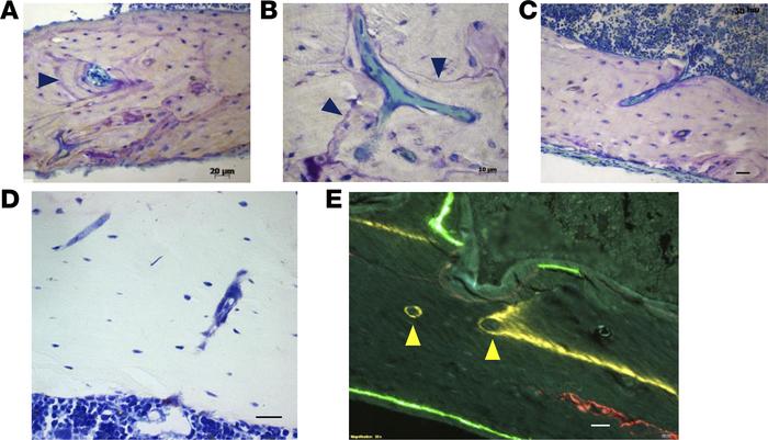 JCI Insight - Old age causes de novo intracortical bone remodeling and ...