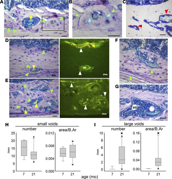 JCI Insight - Old age causes de novo intracortical bone remodeling and ...