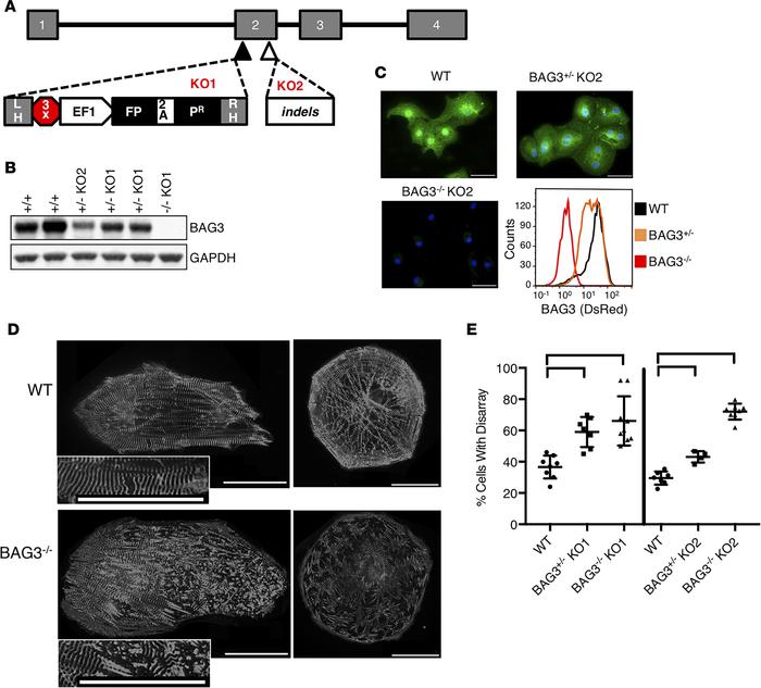 JCI Insight - A BAG3 chaperone complex maintains cardiomyocyte function ...