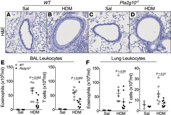 JCI Insight - Secreted PLA2 group X orchestrates innate and adaptive ...