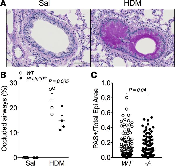 JCI Insight - Secreted PLA2 group X orchestrates innate and adaptive ...