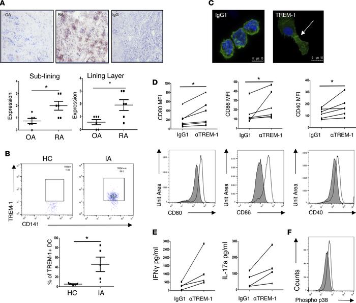 JCI Insight - Enriched Cd141+ DCs in the joint are transcriptionally ...