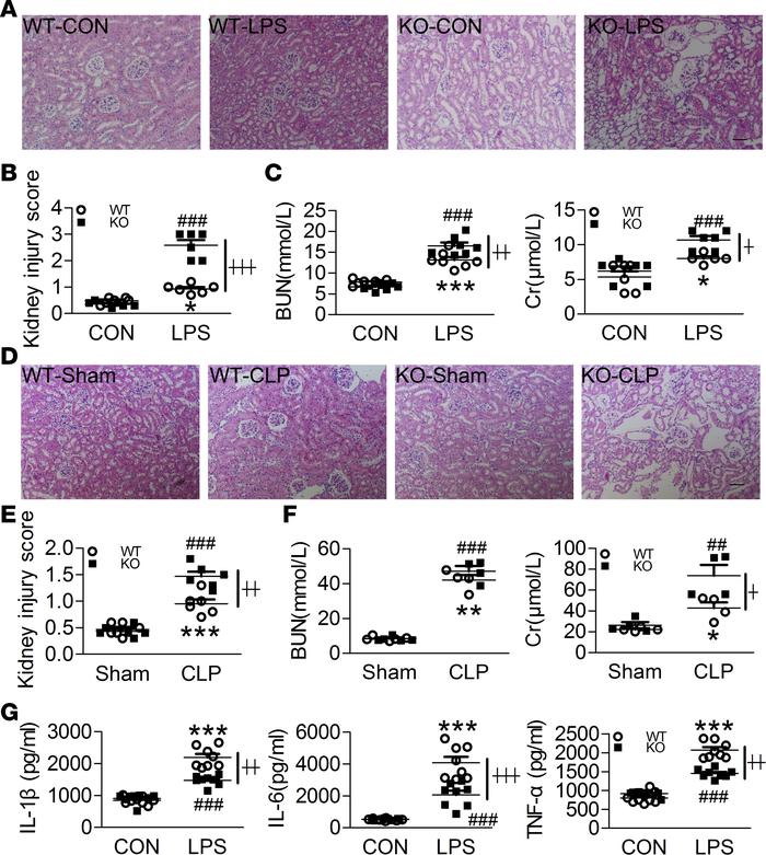 JCI Insight - Swiprosin-1 deficiency impairs macrophage immune response ...