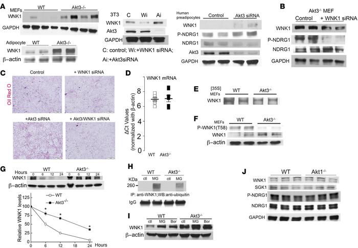 JCI Insight - Akt3 inhibits adipogenesis and protects from diet-induced ...