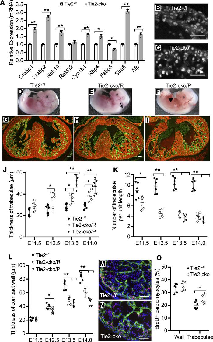 JCI Insight - Tie2 regulates endocardial sprouting and myocardial ...