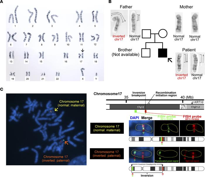 JCI Insight - Chromosomal inversions as a hidden disease-modifying ...