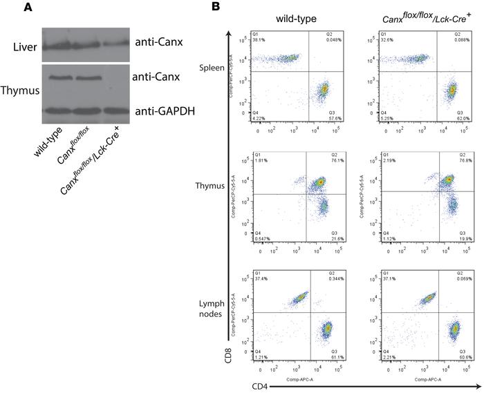 JCI Insight - Calnexin is necessary for T cell transmigration into the ...