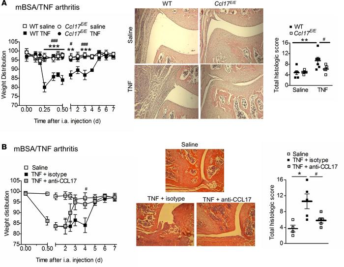 JCI Insight - TNF and granulocyte macrophage-colony stimulating factor ...